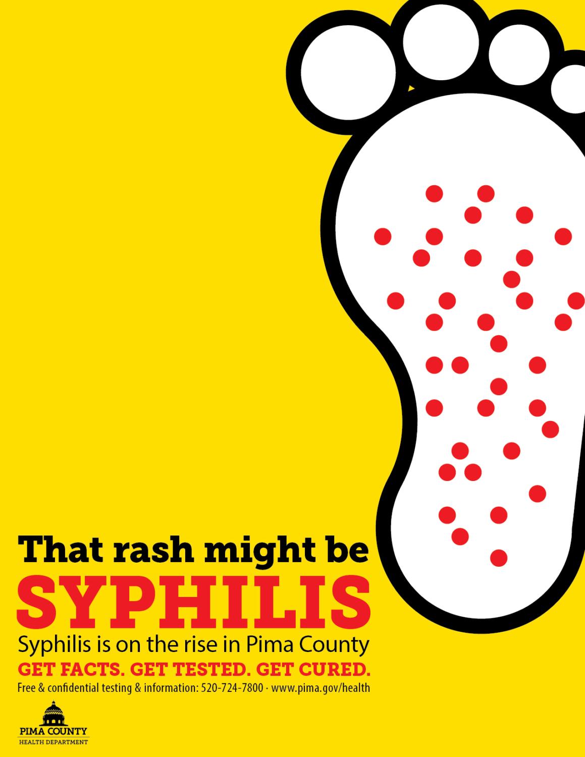Syphilis is on the rise – BHOC